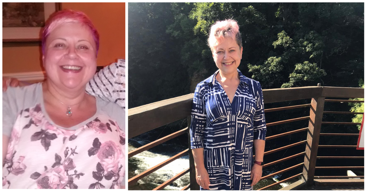 Woman who lost 12 stone launches crowdfunder to remove loose skin